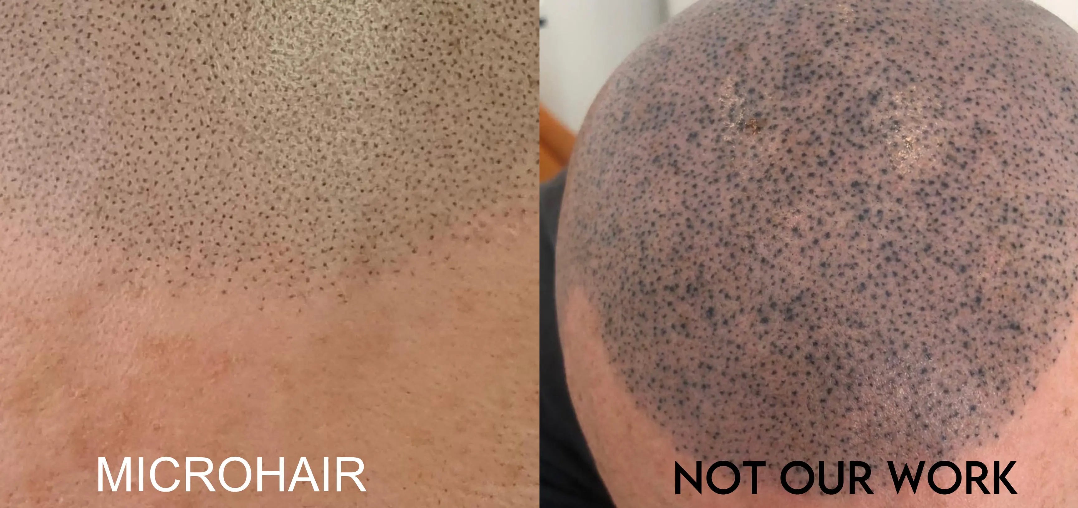 Don't be a Victim of Bad SMP Work! - MicroHair